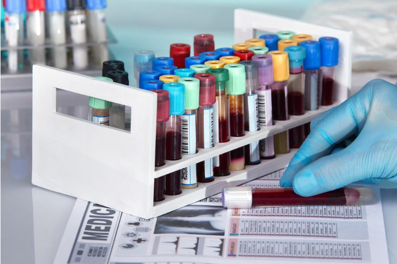 Keeping Medical Specimens Safe During Transit: What Hospitals Should ...